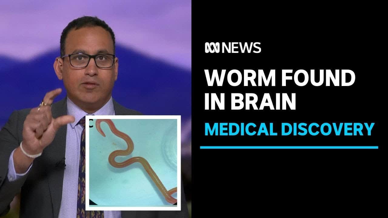 Live Snake Found in Human Brain - Medical Marvel | PhotoNews